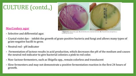 Phenotypic Methods Of Bacterial Identification Conventional And Automatedpptx Infectious