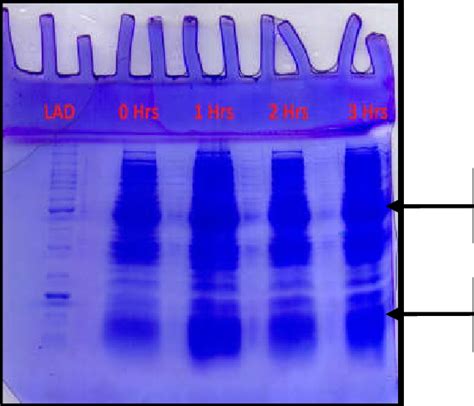 6 BL 21 Transformed Colony Were Induced With IPTG In Every 1 Hour