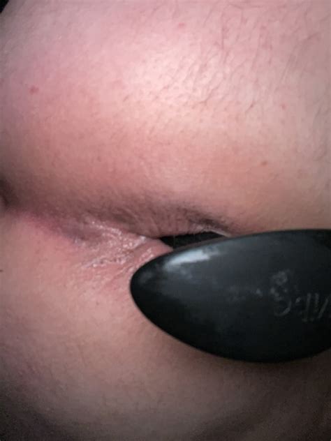 My Cute Stretched Hole Pics XHamster