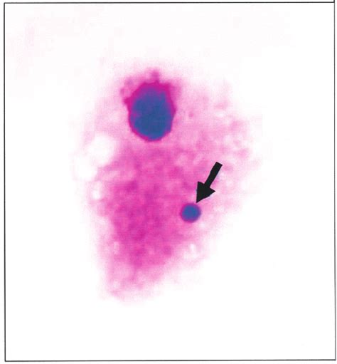 Micronucleus Assay A Micronucleated Agranular Haemocyte From M Edulis Download Scientific