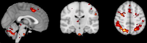 Introduction — Andys Brain Book 10 Documentation