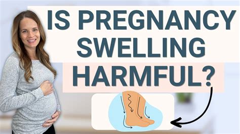 Swelling In Pregnancy What Is Normal Vs When To Worry Youtube