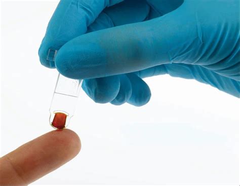 Hemoglobin Test Kit For Lab At ₹ 22 Piece In Gorakhpur Id 2855261036048