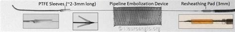 Pipeline Device Guide