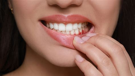 Understanding Gum Disease Signs Symptoms And Treatment Options