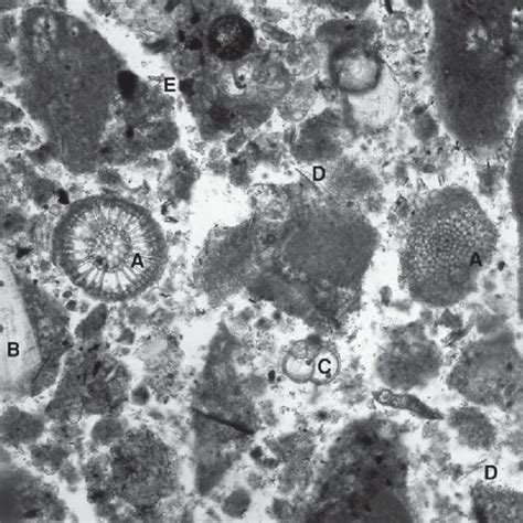 Detail Of A Burnt Bone Splinter About 1 Mm Long Coated By Ash View