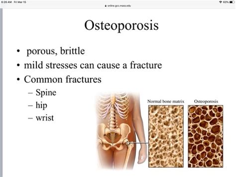 Unit III Lecture Musculoskeletal Trauma Orthopedic Surgery Flashcards Quizlet