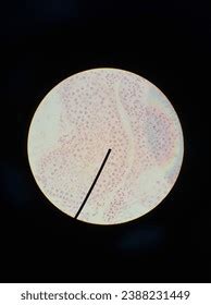 Male Reproduction System Testis Under Microscope Stock Photo Shutterstock