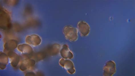 Пыльца сосны под микроскопом. - YouTube