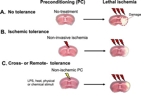 Ischemic Tolerance Induced By Glial Cells Pmc