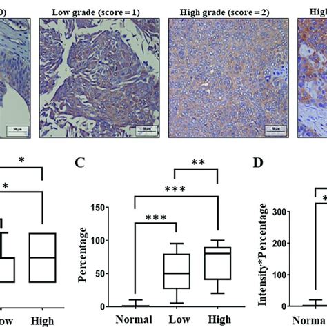 Evaluation Of The Clinical Significance Of Cdcp1 By Using Tissue