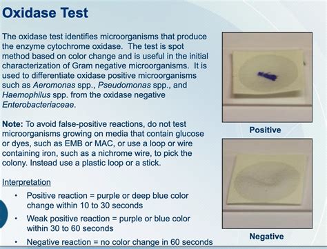 Oxidase Test