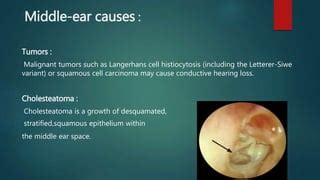 Conductive Hearing Loss Pptx