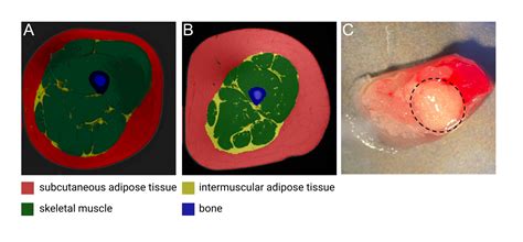 Video Author Spotlight Deciphering The Cellular Mysteries Of Intermuscular Adipose Tissue In