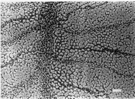 The Outer Surface Of The Chorio Allantoic Membrane In A 10 Day Old