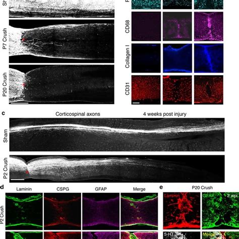 Microglia Isolation And Transplantation A Representative Images Left Download Scientific