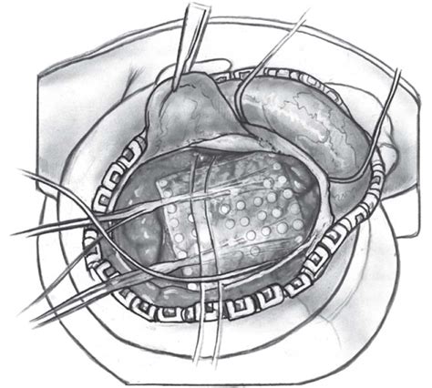 Temporal Approach Neupsy Key