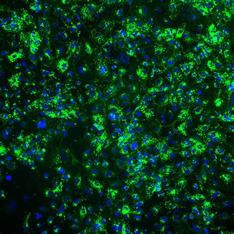 Immortalized Huvec Innoprot Immortalized Primary Cells