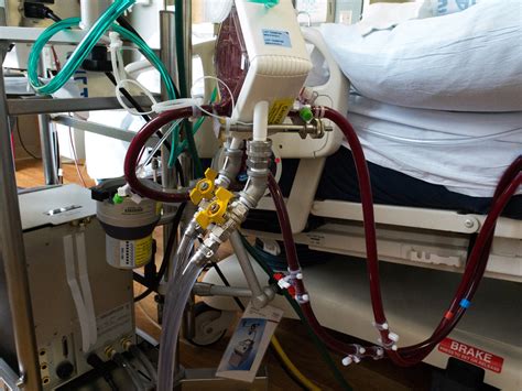 Ethical Considerations In Initiating Va Ecmo In Incapacitated Individuals The Cardiology Advisor