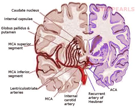 Anatomy Head And Neck Striate Arteries Pediatric Article Statpearls