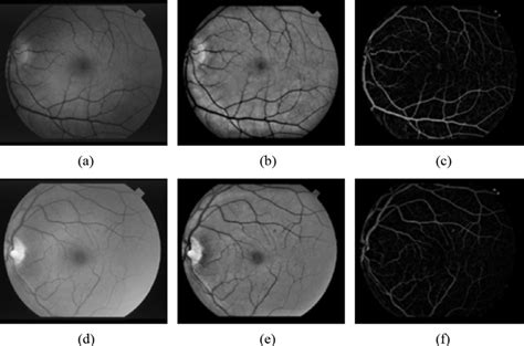 Two Examples Of Application Of The Preprocessing On Two Images With