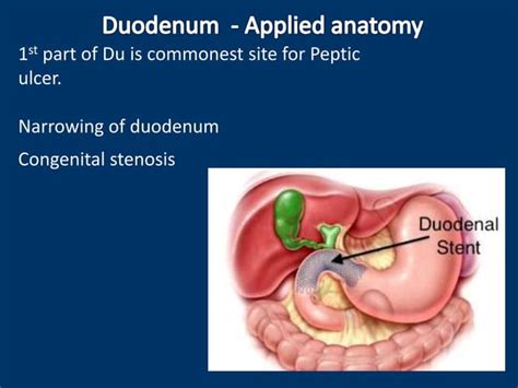 Anatomy Of Duodenum Duodenum Structure Ppt Of Duodenum Power Point Presentation Duodenum