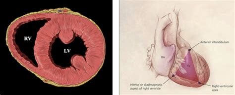 Right Ventricle Flashcards Quizlet