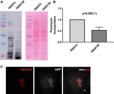 A Puromycin Incorporation Assay Was Performed Using Anti Puromycin
