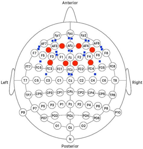 Dorsolateral Prefrontal Cortex Dlpfc