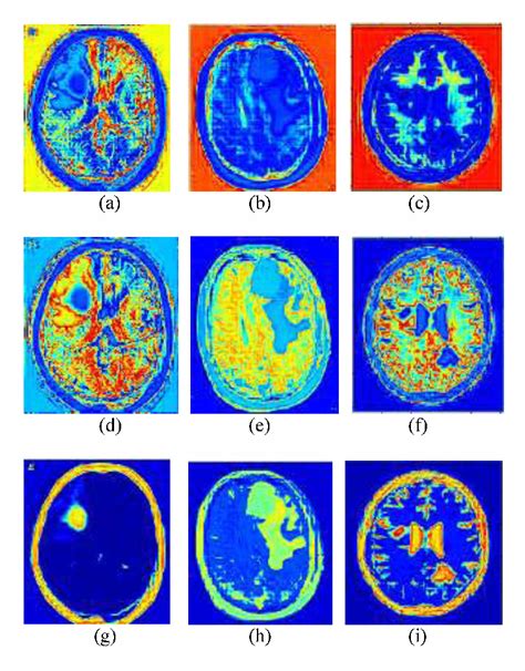 figure 6 from multi focus and multi modal image fusion using wavelet