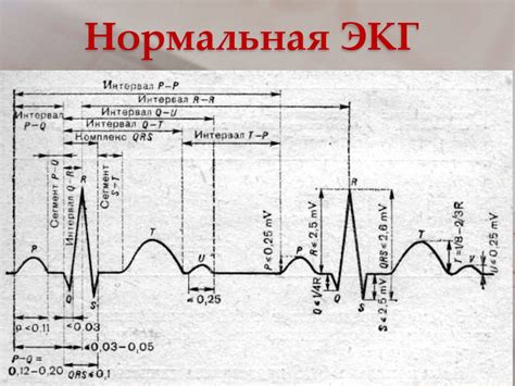 Основы ЭКГ - презентация онлайн
