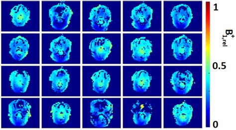 5 Qualitative Normalized B 1 Magnitudes Plotted As Color Of 20