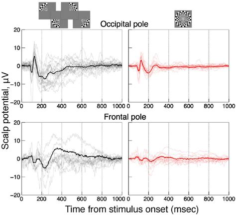 Scalp Veps At An Occipital Electrode Top Panel And A Frontal Download Scientific Diagram