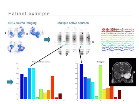Ictal Eeg Source Imaging Pptx Brain And Nervous System Disorders