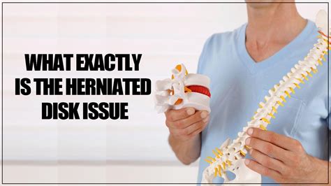 Bed For Herniated Disk At Savannah Derrington Blog