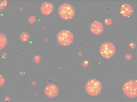 cancer modeling and new drug target identification — bassik lab