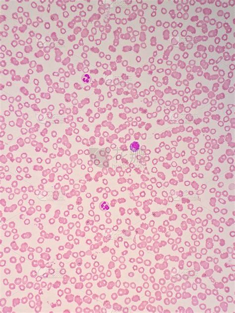 显微镜下的人类血细胞