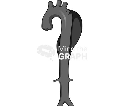 Free Aortic Dissection Classification 3a Icons Symbols Pictures And