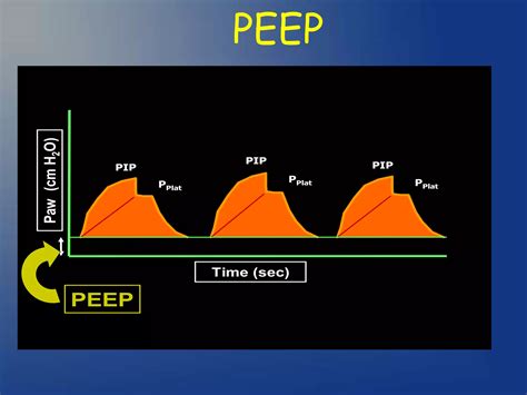 Ventilator Waveforms Dr Sanjay Chugh Pptx Lung And Respiratory Health