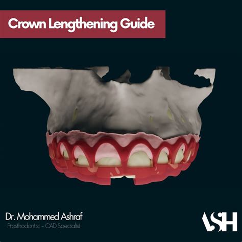 Dr Mohammed Ashraf Dr Mohammedash • Instagram Photos And Videos