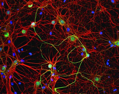 Separate Neural Circuits Control Cravings Vs Healthy Eating Researchers Find Your