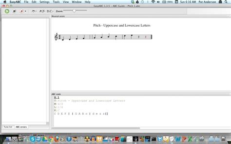Pitch ABC Music Notation