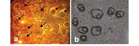 Laser Capture Microdissection Of E14 5 Lim1 Mutant Renal Vesicles A