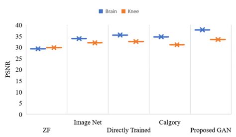PSNR Values Of Reconstructed Images Of The Knee And Brain Using Download Scientific Diagram