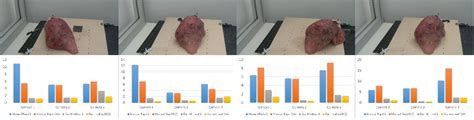 Pdf Silhouette Based Pose Estimation For Deformable Organs