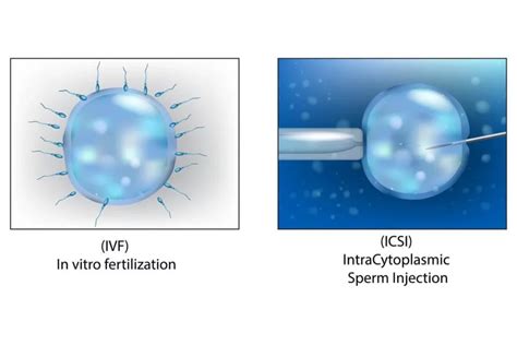 ICSI Vs IVF Difference Between IVF And ICSI Grace Fertilty