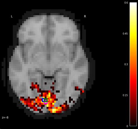 Brain Encoding — Introduction To Brain Decodin In Fmri