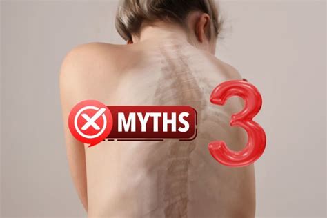 The Top Myths About Upper Cervical Chiropractic Debunked