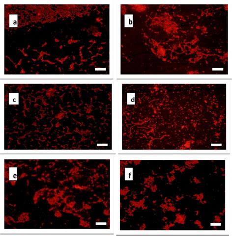 Whole Cell Rrna Targeted Fluorescence In Situ Hybridization Of Download Scientific Diagram