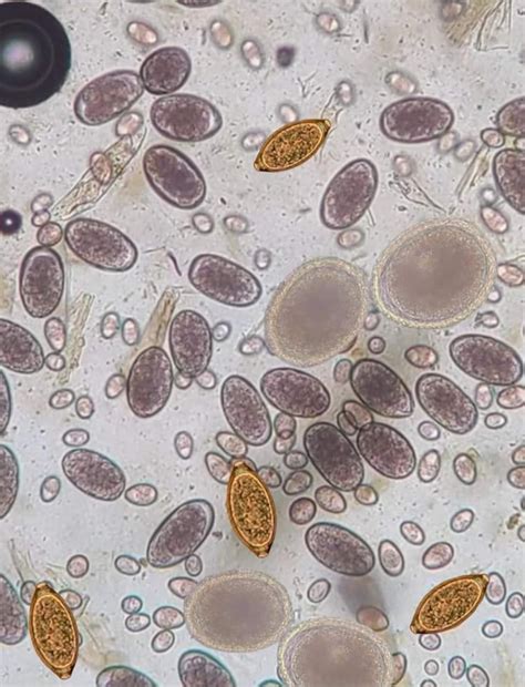 Fecal Float In 2024 Microbiology Roundworm Sea World
